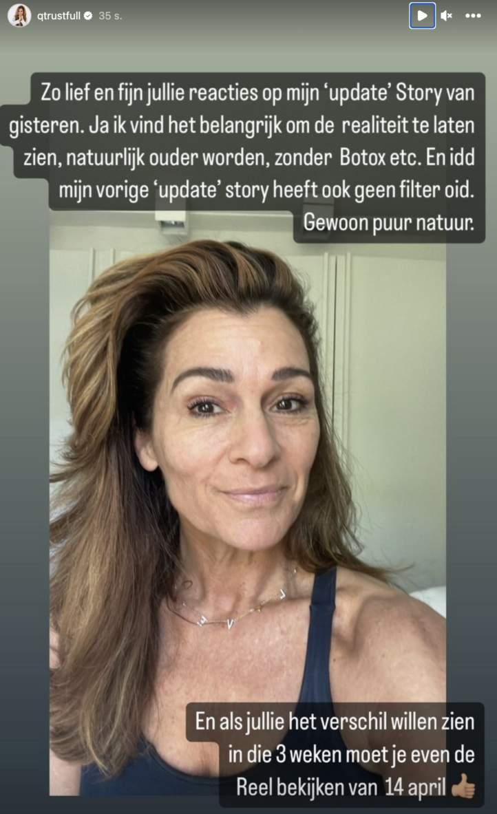 Quinty Trustfull open over Botox: 'Belangrijk om de realiteit te laten ...